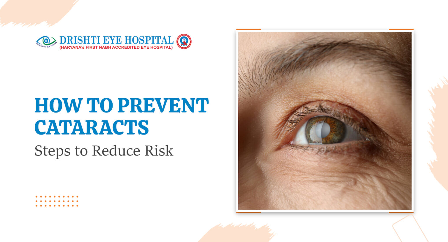 How to prevent from cataract : 8 best ways